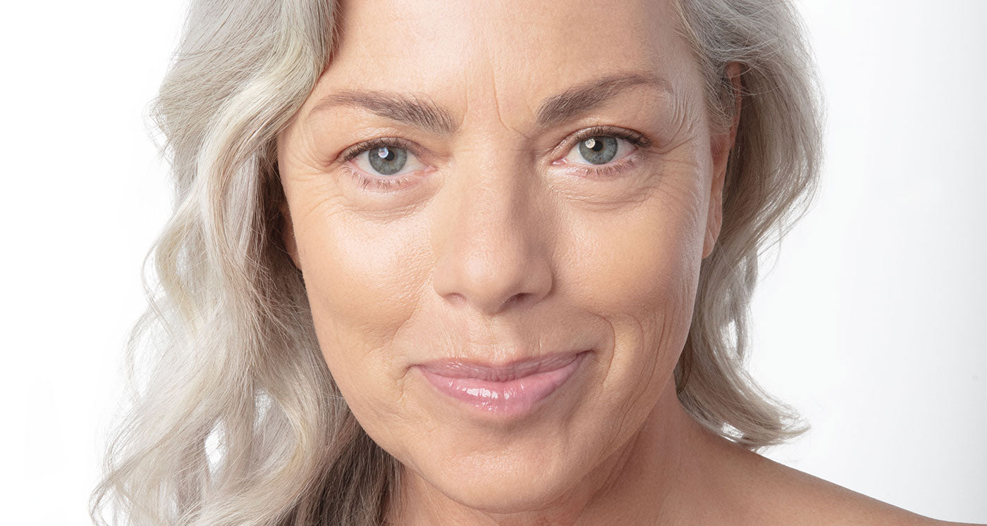 Static vs. Dynamic- Get The Low Down On Wrinkles! – Dermelect ...